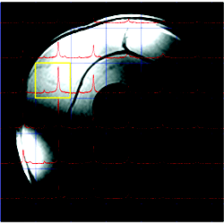 MRI image with CSI dataset.