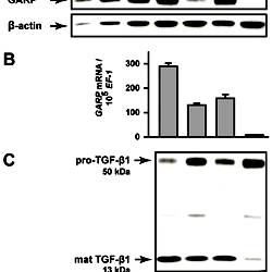 A short GARP 3’ UTR region controls GARP levels and production of TGF ...