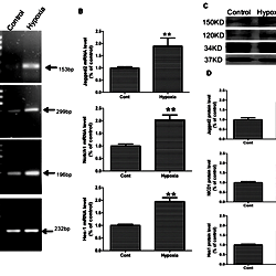 The mRNA and protein expressions of Jagged-2, Notch-1, and Hes-1 for ...