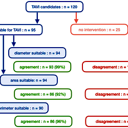 Theoretical TAVI prosthesis size selection (Edwards SapienValve).