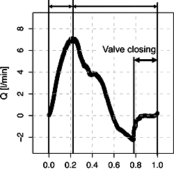 Waveform of the pulsatile inlet flow.