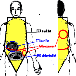 Trunk fat measurements by Anthropometry, MRI, DXA and CT.