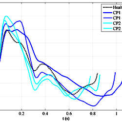 CSF flow waveforms at C2 for each case (Q represents flow).