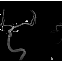 Segmentation of intracranial arteries.
