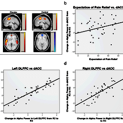 Significant sources of alpha activity.