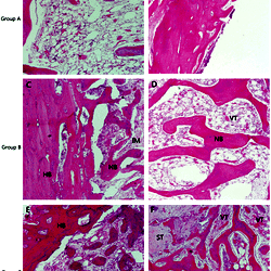 Histology photomicrographs of H&E staining of bone defects (10X) for ...