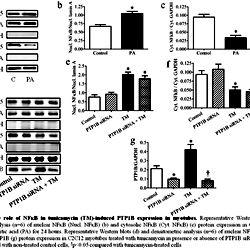 Figure S1 - Protein Tyrosine Phosphatase 1B and Insulin Resistance ...