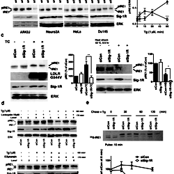Sigma-1 receptors stabilize IRE1.