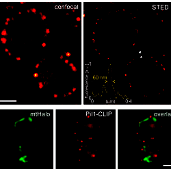 Live cell super-resolution microscopy and multi-colour microscopy using ...