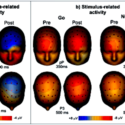 Scalp topography maps.