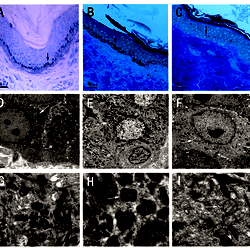 Skin histological examination under light and electron microscopy.