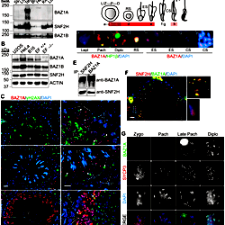Expression and localization of BAZ1A in male germ cells.