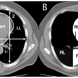 Figure shows a schematic representation of the CT image parameters ...