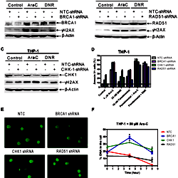 The roles of BRCA1, CHK1, and RAD51 in cytarabine- or DNR-induced DNA ...