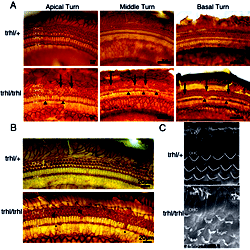 Stained cochlear sections and SEM reveal hair cell loss and altered ...