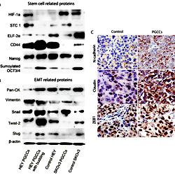 Western blot analysis of stem cell-related proteins expressed in HEY ...