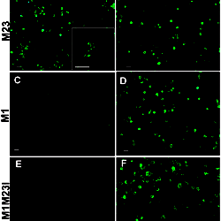Changes in sensitivity of the CBE test using cells transfected with ...