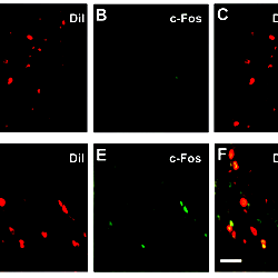 Enhanced c-Fos expression in DiI-labeled DRG neurons following HT7-MAI ...