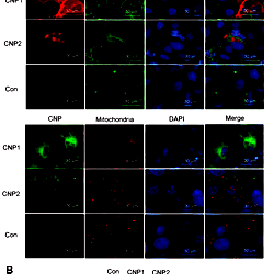 Subcellular location of CNP isoforms in Huh7 cells.