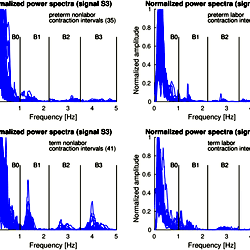 Normalized power spectra of contraction intervals of signal S3 of the ...