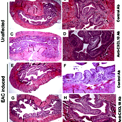 Histopathological changes in the urinary bladders of chronic EAC mice ...