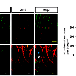 Double immunofluorescence of Sox10 and Hu in myenteric plexus of P0 ...