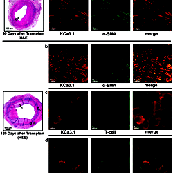KCa3.1 staining localizes to smooth muscle cells, T cells and macrophages.