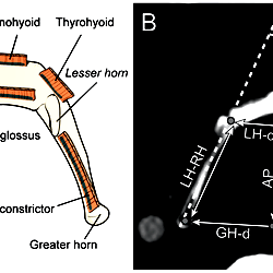 Anatomy of hyoid bone and new parameters.