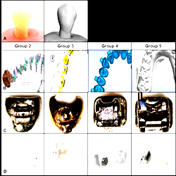 The design and fabrication of customized brackets.