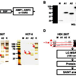 Affinity purification of SBP-tagged AIMP1, AIMP2 and KARS.