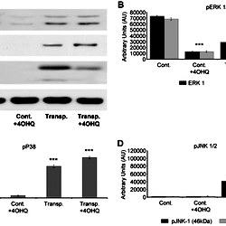 Effect of PARP inhibitor on activation and phosphorylation of ERK1/2, JNK1/2 and p38 MAP kinase ...