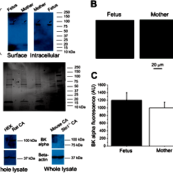 BK channel-forming alpha subunit in cerebral artery myocytes of fetal ...