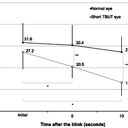 Changes in MTF cutoff frequency after the blink in normal eyes and eyes ...