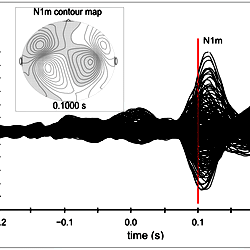 Auditory evoked magnetic field and contour map for the N1m response – experiment 2.
