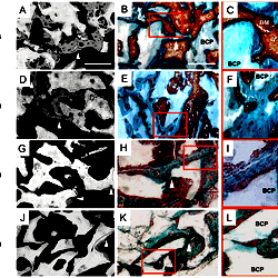 Ectopic bone formation at 8 weeks.