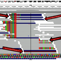 Example IGV screenshot of a 71bp tandem duplication in the BRCA2 gene identified by SoftSearch.