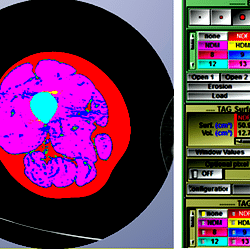 The skin and bone marrow tag with a mixture of colors assigned to the ...