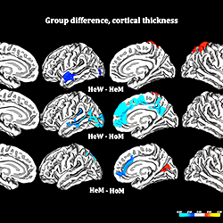 Group comparisons for Cth.