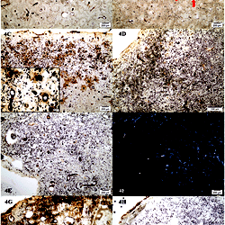 Micrographs showing the patterns of bioerosion and associated staining ...