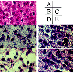HE staining result of subcortex brain injury tissue (400×) in each group.