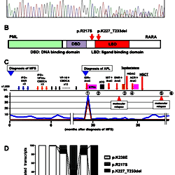 Clonal expansion of PML-RARA mutant cells during APL progression.