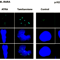 The deletion mutation alters PML-nuclear body formation by RA in ...