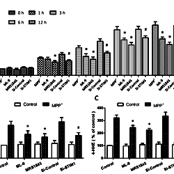 Inhibition of SOCE inhibits MPP+-induced ROS generation and lipid ...