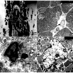 Ultra structure of the myocardium under an electron microscope.