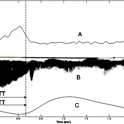 Pre-ejection period.