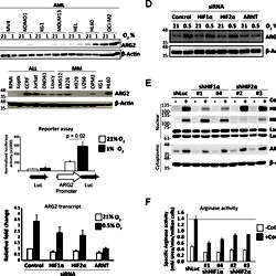 ARG2 is expressed in subsets of hematologic malignancies and is ...
