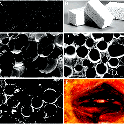 Vascular casting method.