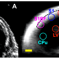 Coronal B-scan ultrasound images at the level of the LPS injection.