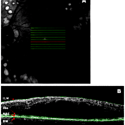 A representative OCT image with layers segmented using EdgeSelect.