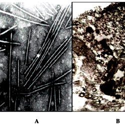 Electron micrographs showing flexuous rod particles in purified virus ...
